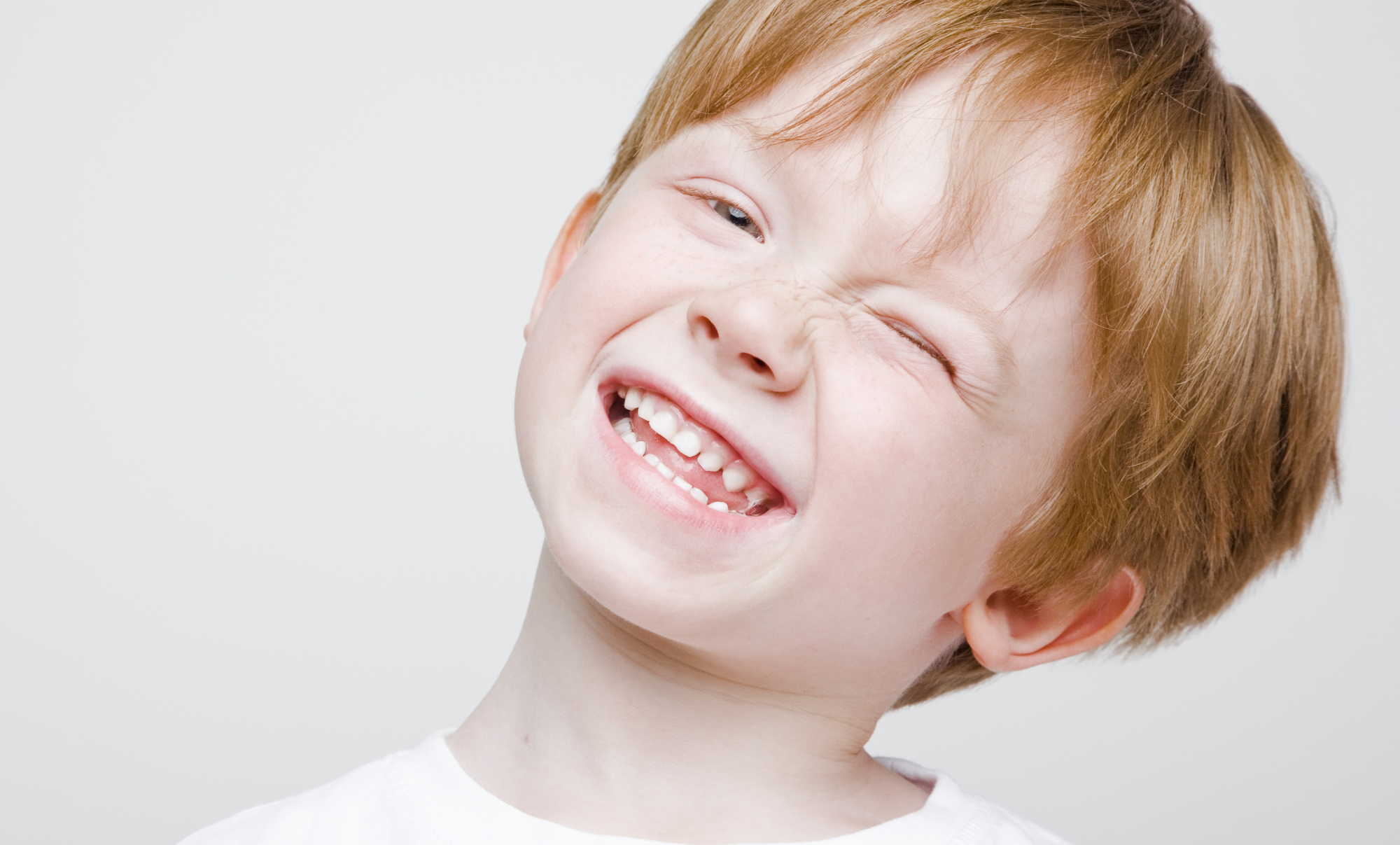 ICON Resin Infiltration - Sea & Smiles Pediatric Dentistry